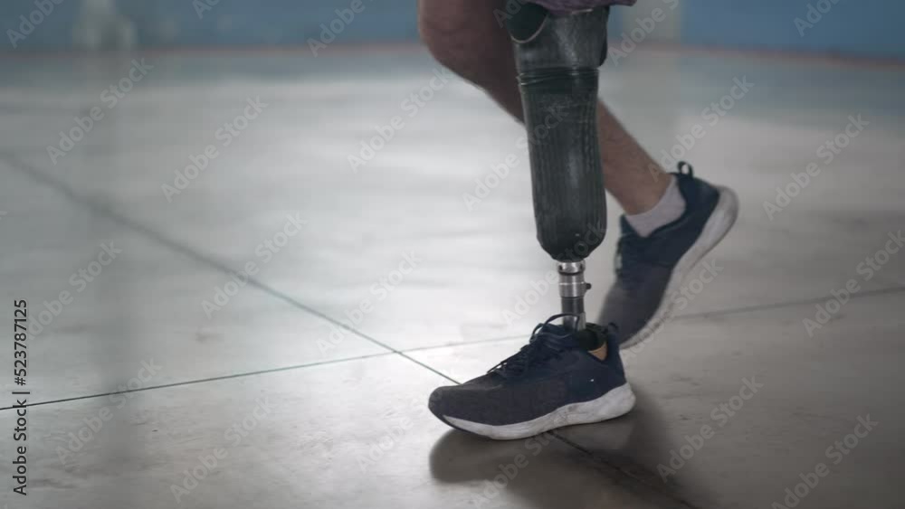Disabled person walking with his prosthetic leg indoors. Amputee man ...