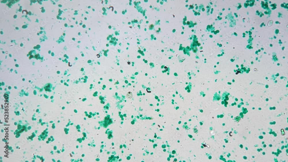 Chlamydomonas whole mount 200x under microscope against bright field. A ...