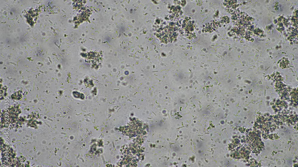 coughing, Phlegm and mucus under the microscope Stock ビデオ | Adobe Stock