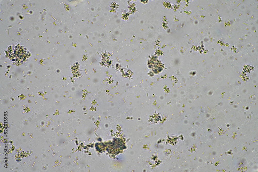Yogurt under the microscope. Looking at lactobacillus bacteria in a ...