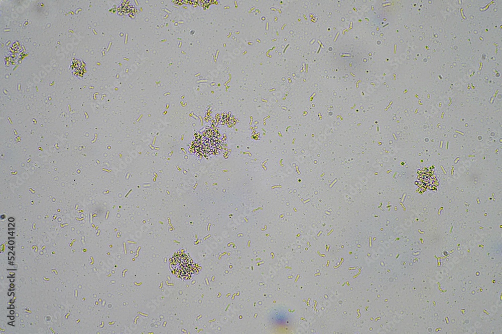 coughing, Phlegm and mucus under the microscope Stock Photo | Adobe Stock