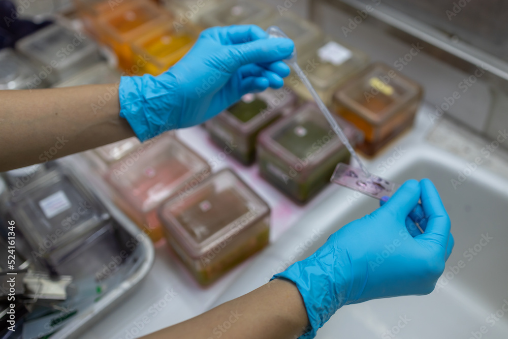 Scientists are preparing slides cytology or pathology for the ...