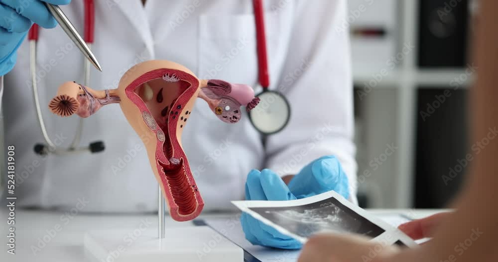 Gynecologist demonstrates model of female reproductive system to woman ...