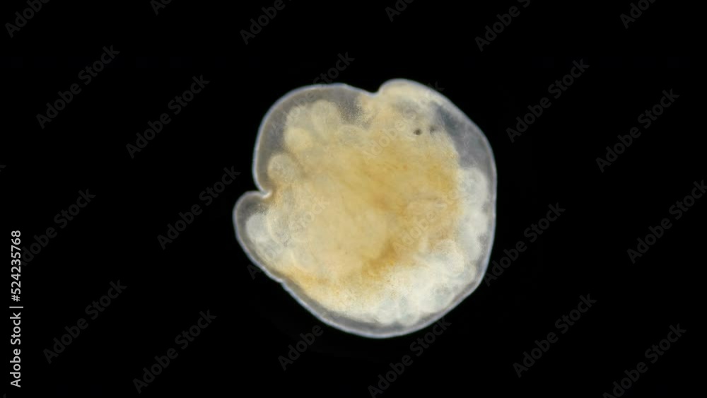 A worm from the family Typhloplanidae under a microscope, Order ...