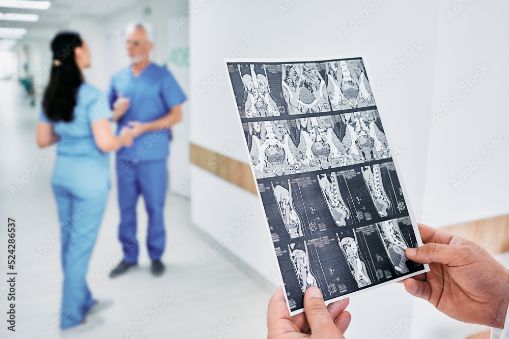 CT scan of the patient's abdomen in doctor hands, close-up, over ...