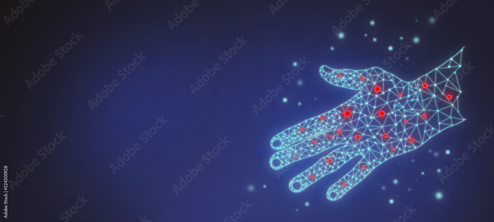 A neon hand with signs of monkey pox, chicken pox, or a skin rash ...