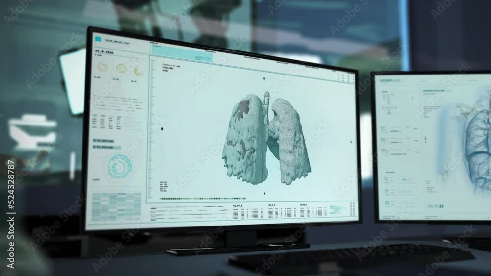 Patients Lung Organ Treatment Using Futuristic Software Interface ...