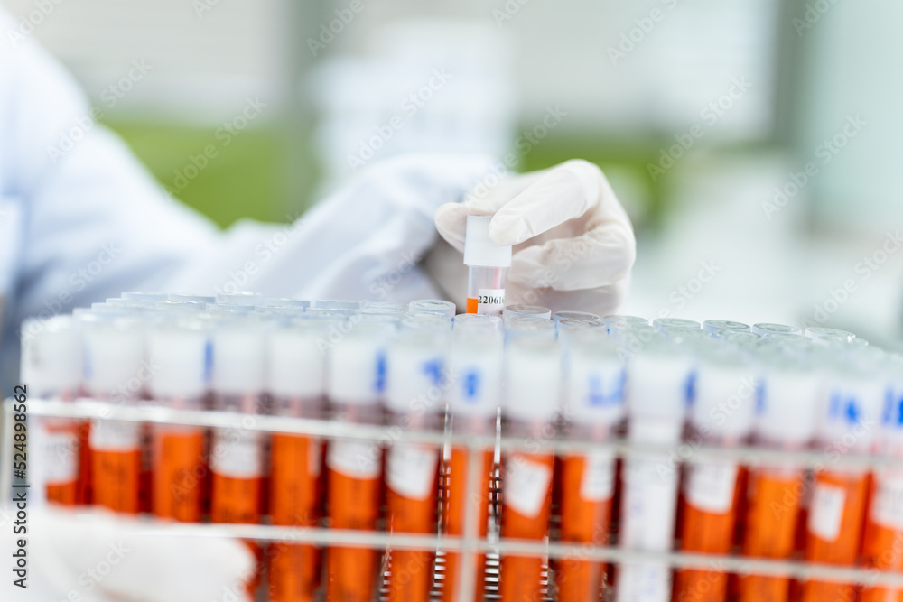 Scientist hand with a tube of blood sample and a rack with other ...