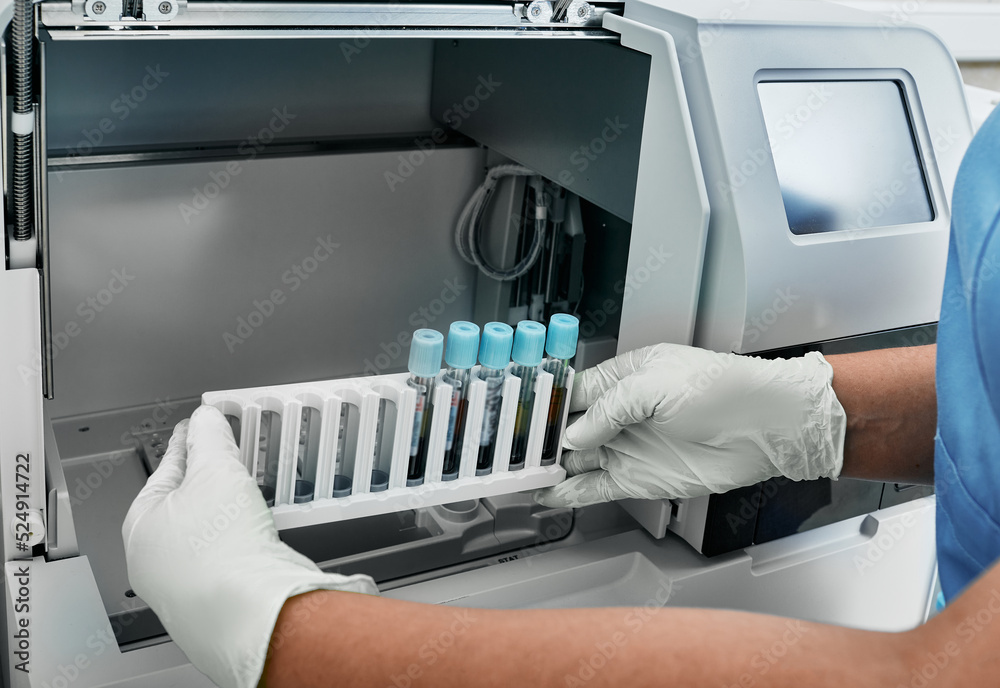 Lab technician loading blood samples for coagulation test analysis in ...