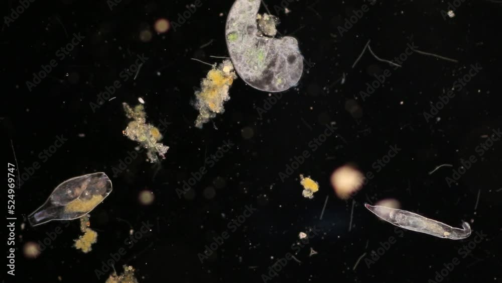 Protozoa and Stentor in waste water under the microscope. vídeo de ...
