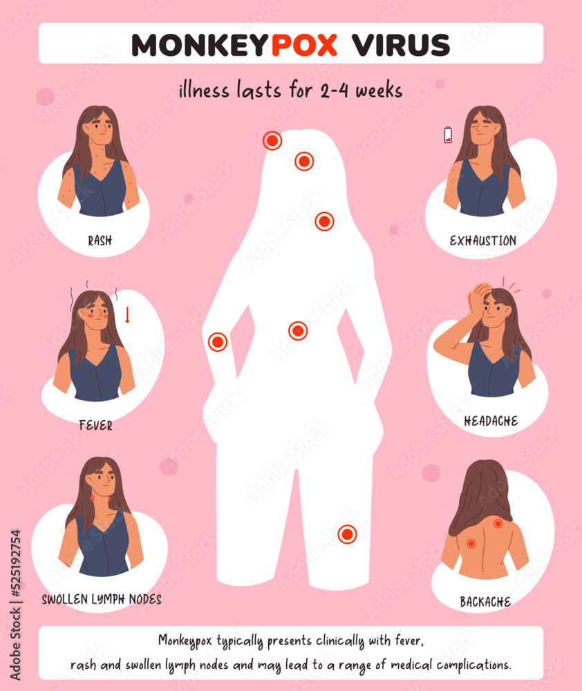 Medical leaflet Monkeypox virus symptoms . Information poster with ...