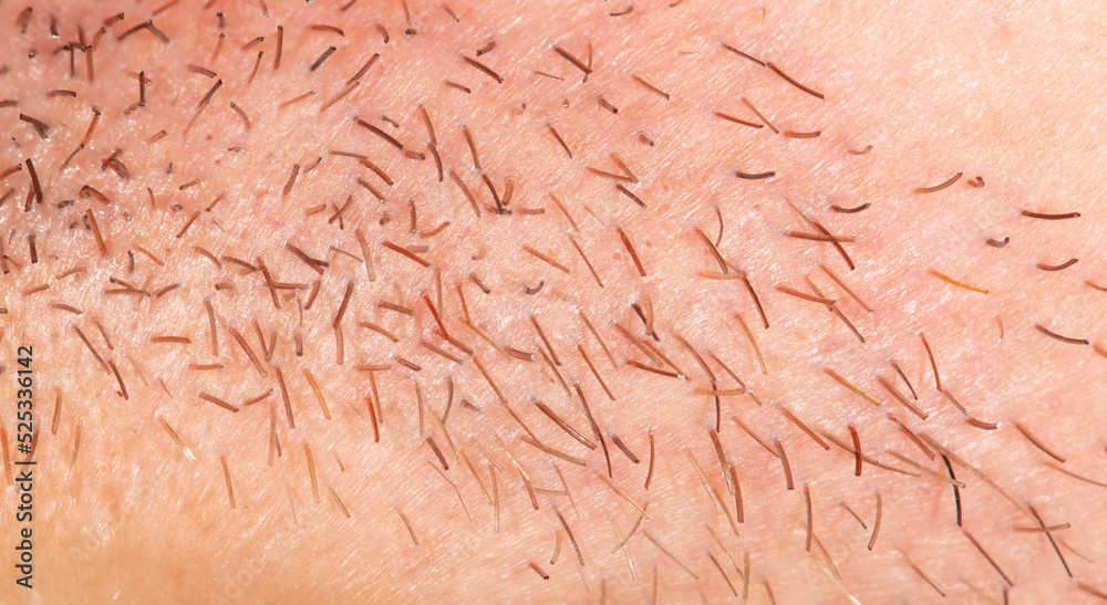 Hair on the skin of a man's face. Macro Stock Photo | Adobe Stock