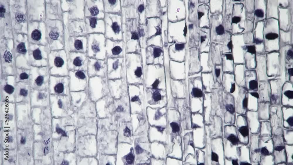 Microscopic slide of Allium cepa root tip in longitudinal section 400x ...