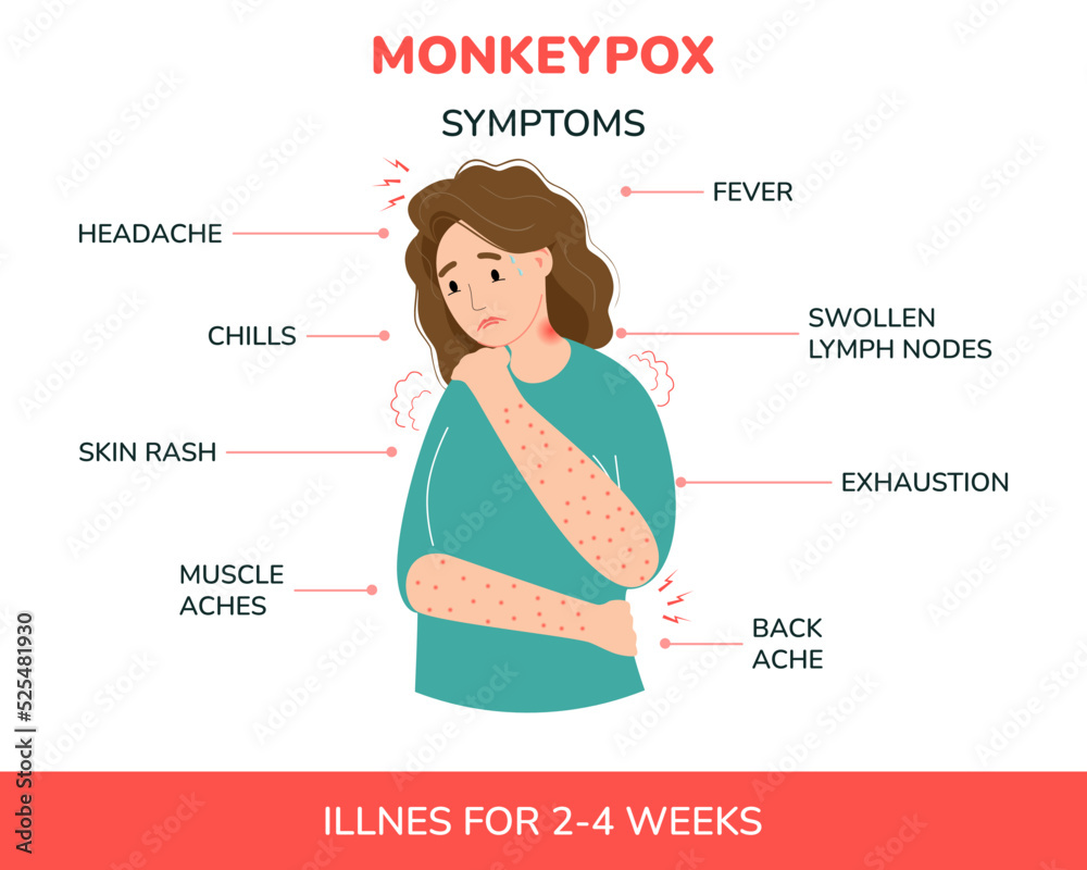 A woman with monkeypox and the symptoms illustration. Fever, headache ...
