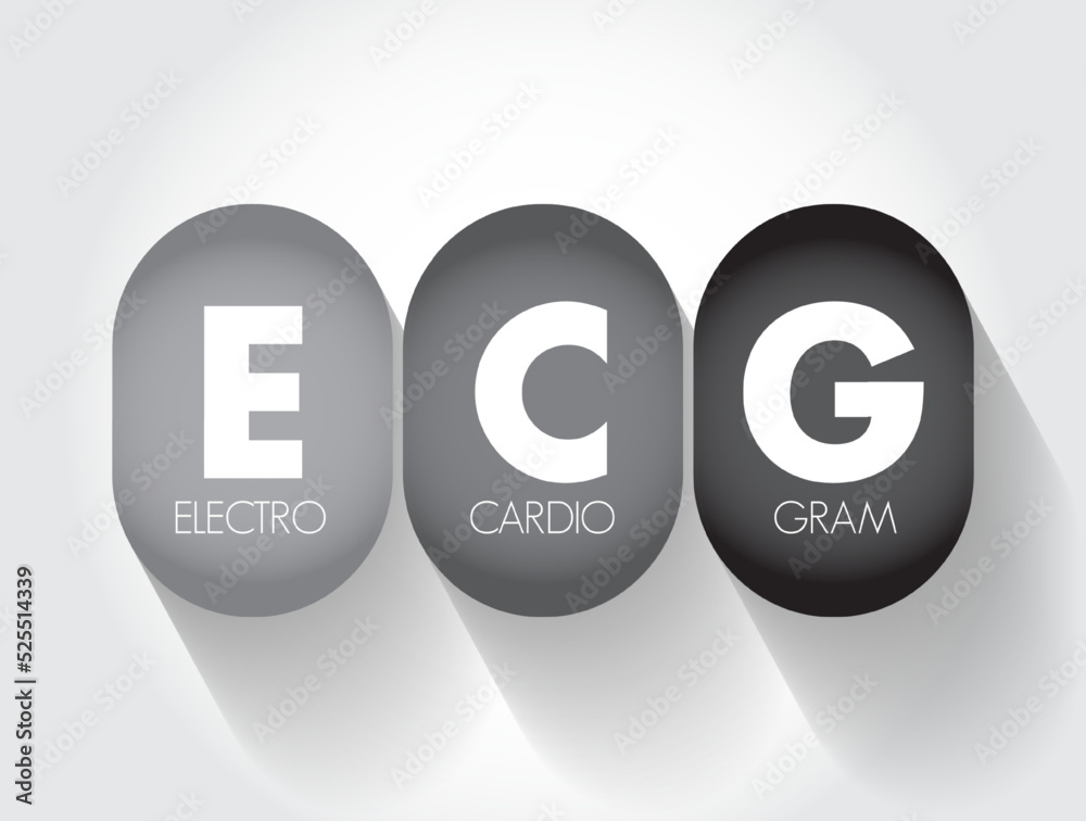 ECG Electrocardiogram - simplest and fastest tests used to evaluate the ...