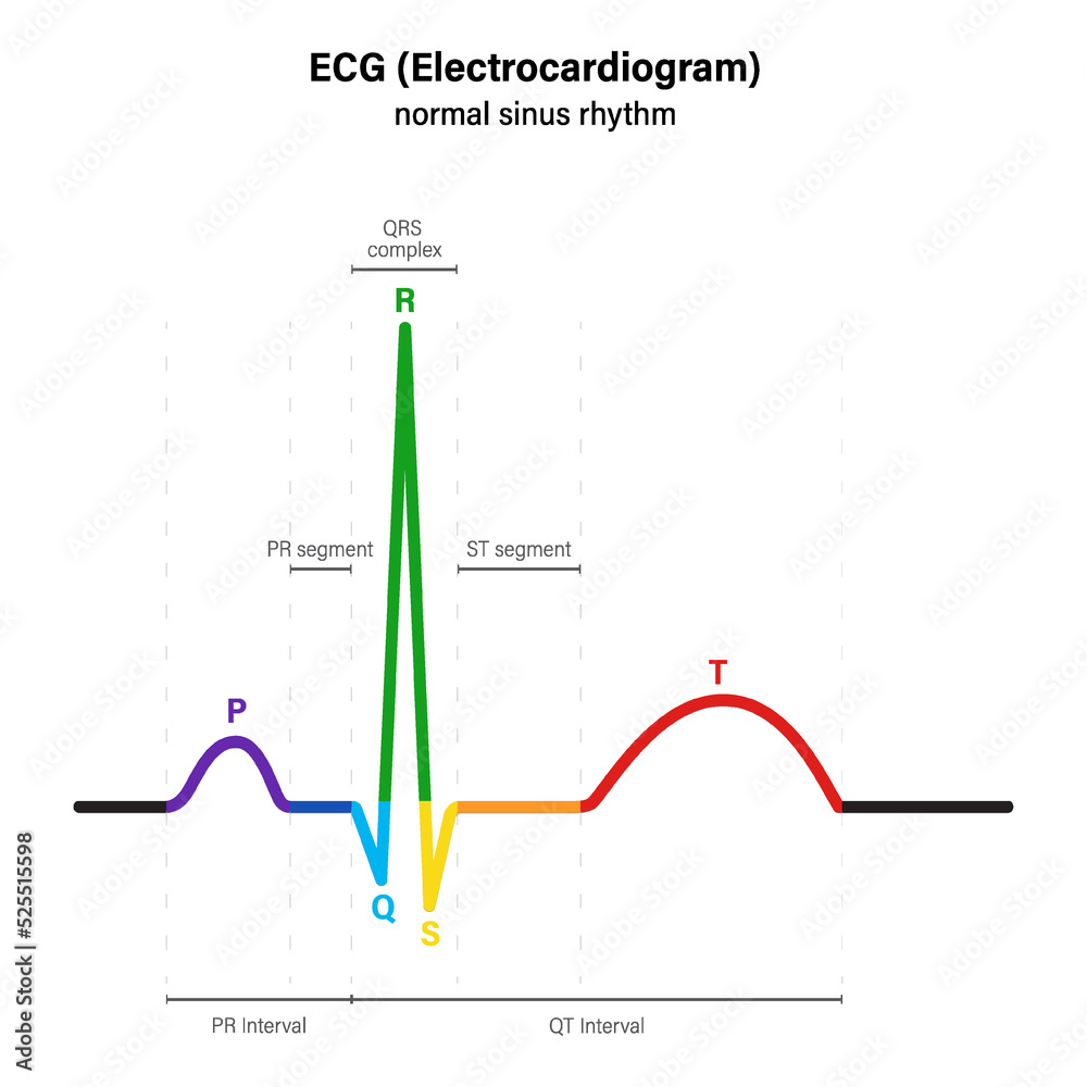 Electrocardiogram (ECG or EKG) of normal sinus rhythm. Vector for ...