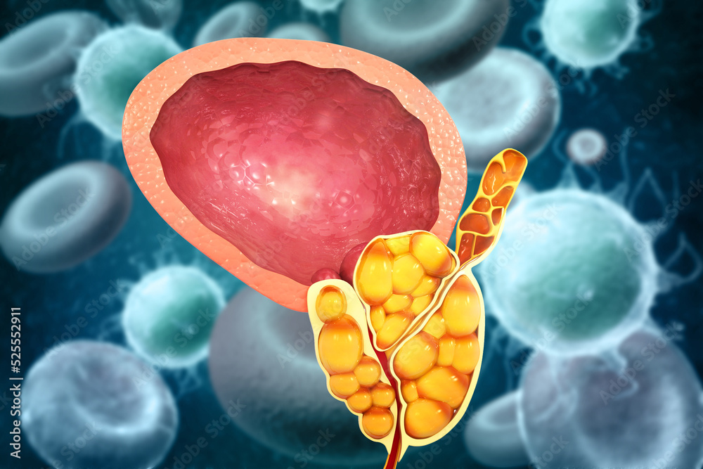 Bladder stones. Cross section. 3d illustration Stock Illustration ...