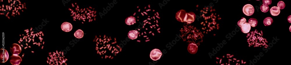 Chromosomes under fluorescence microscope, red colored Human ...