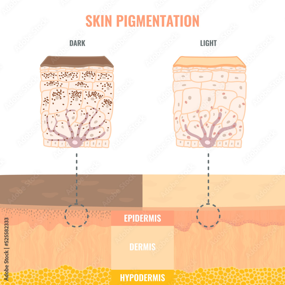 Comparison of melanosomes distribution in dark and light skin ...