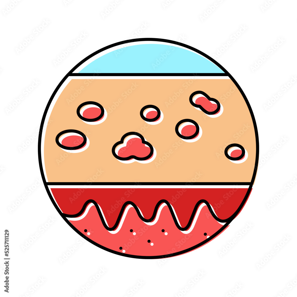 skin rashes hiv symptom color icon vector illustration Stock Vector ...