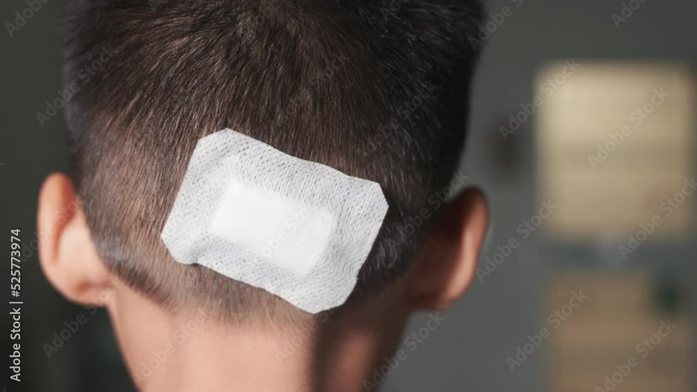 The lacerated suture wound of kid back head which suture with trauma ...