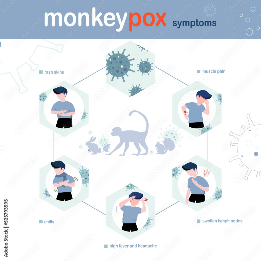 monkeypox outbreak concept, infographic showing an animals that carries ...