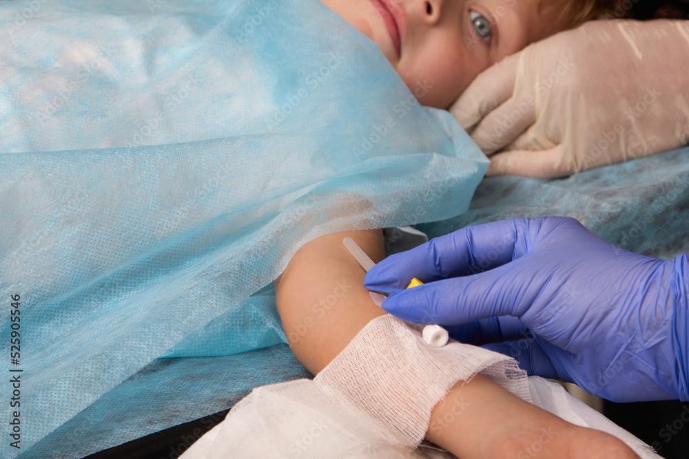 Patient child lies on the operating table with a medication catheter in ...