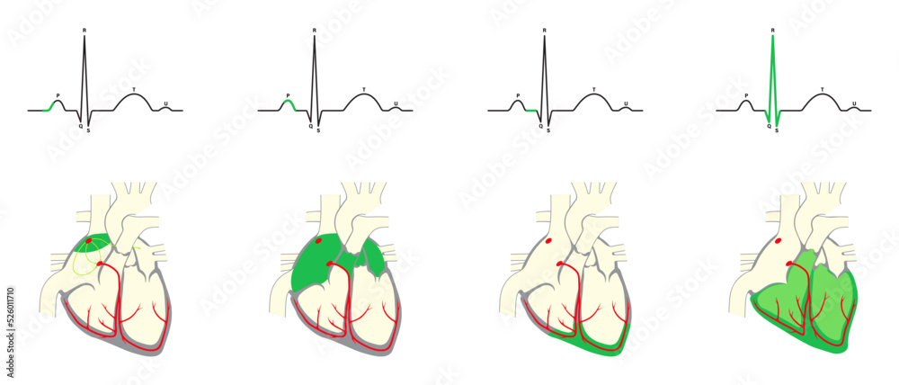 Normal heart rhythm. Electrocardiogram corresponding to the sequence of ...