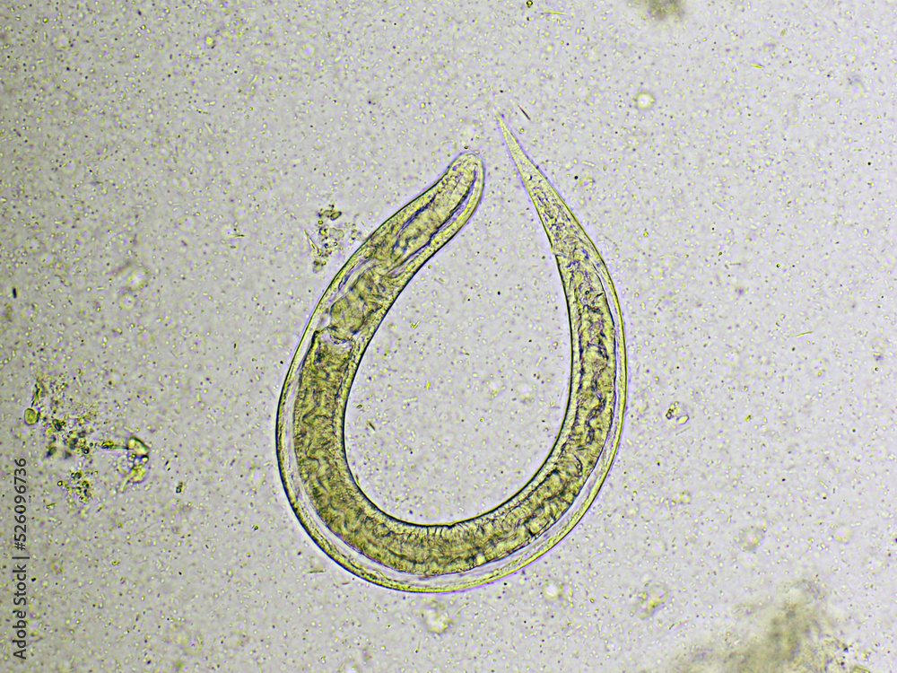 Strongyloides stercoralis or threadworm in human stool, analyze by ...