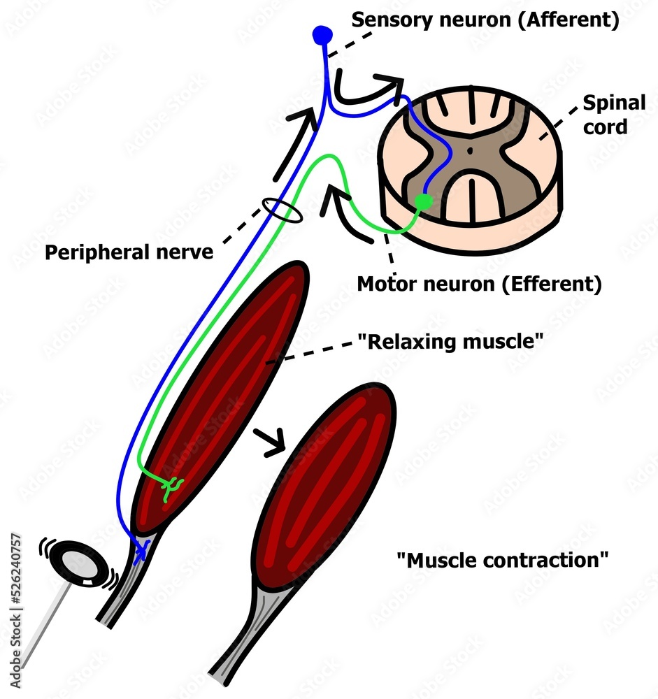 Poster the pathway of reflex responding to neurological physical ...