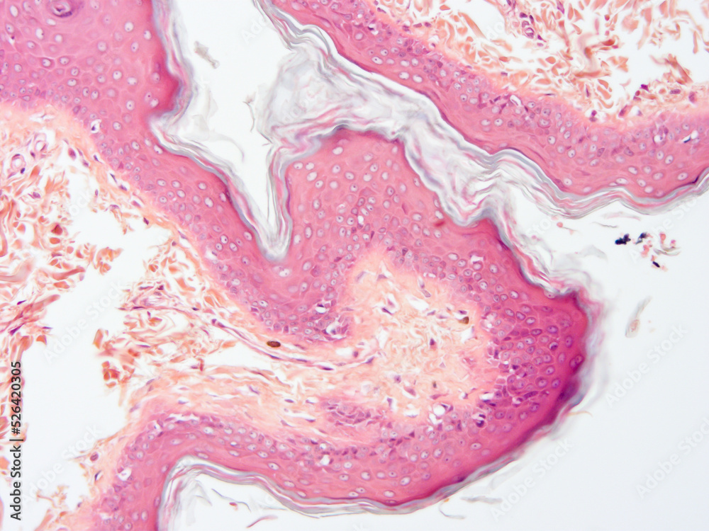 Histology of human tissue, show epithelial tissue and connective tissue ...