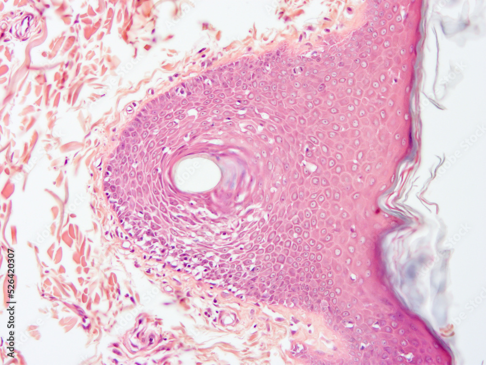 Histology of human tissue, show epithelial tissue and connective tissue ...