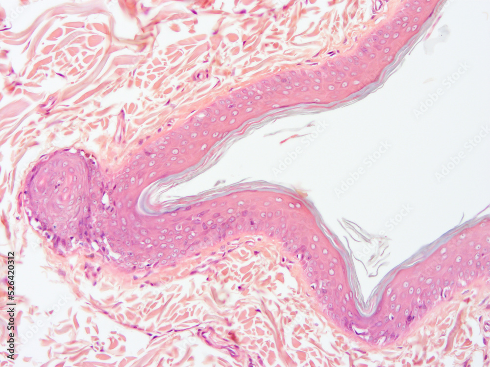 Histology of human tissue, show epithelial tissue and connective tissue ...