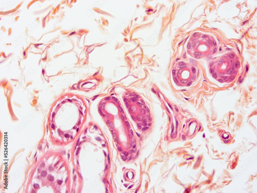 Histology of human tissue, show epithelial tissue and connective tissue ...