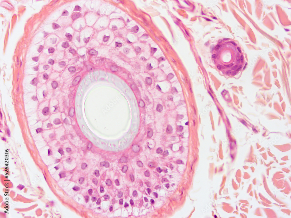 Histology of human tissue, show epithelial tissue and connective tissue ...