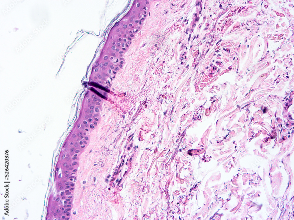 Histology of human tissue, show epithelial tissue and connective tissue ...