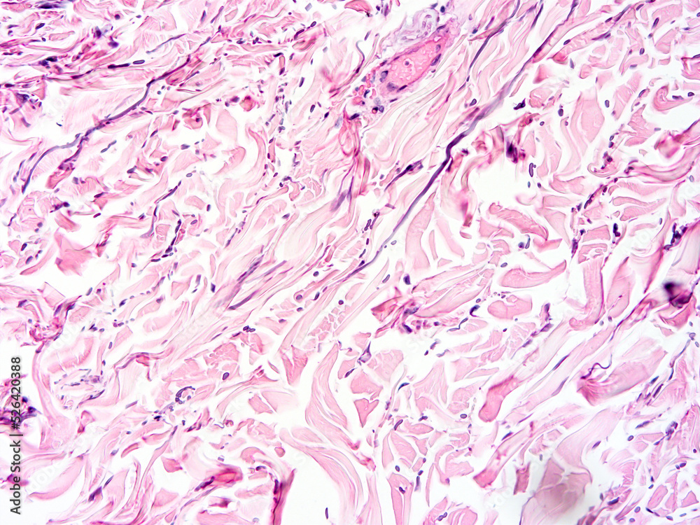 Poster Histology of human tissue, show epithelial tissue and connective ...