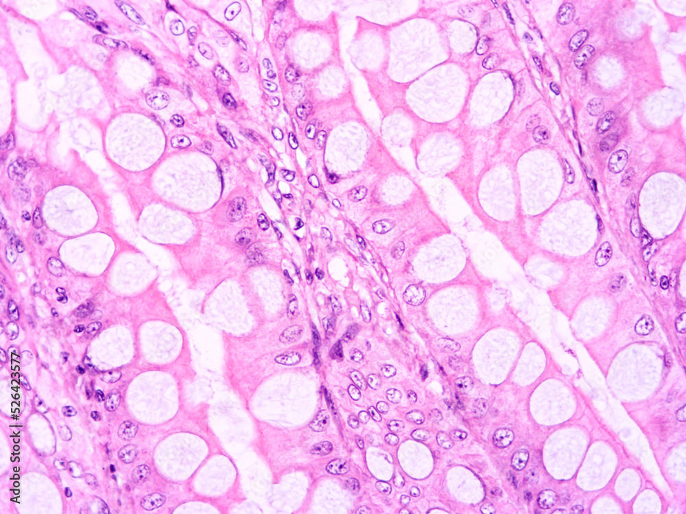 Histology of human tissue, show epithelial tissue and connective tissue ...