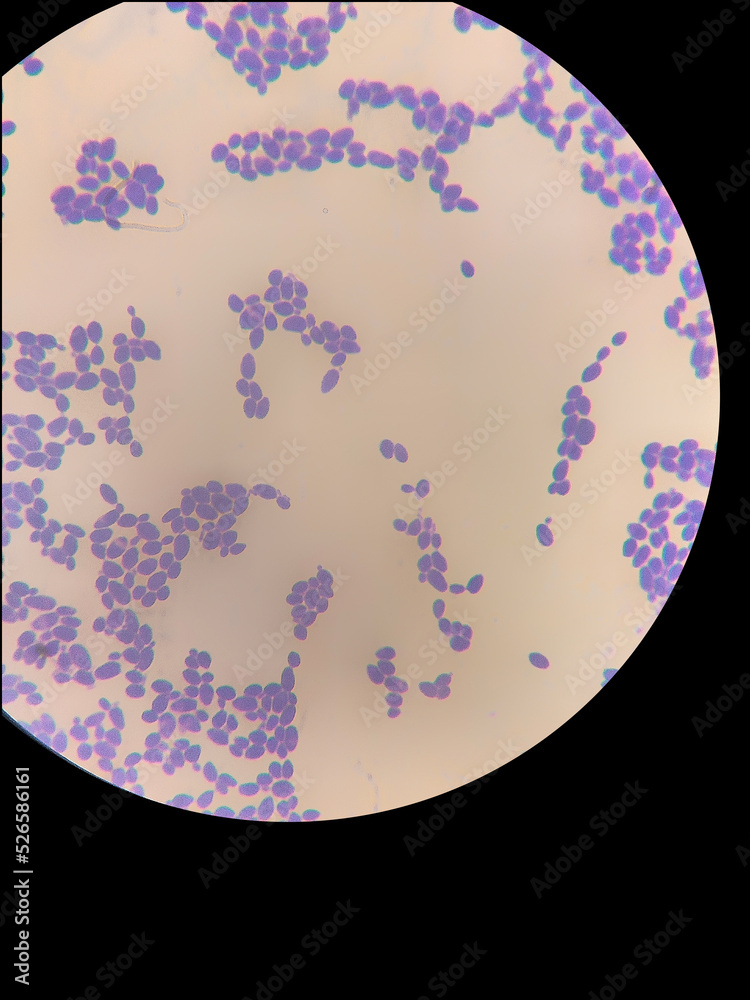 A fixed preparation of yeast stained with gentian violet that buds ...
