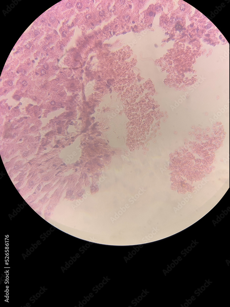 Stained fixed histological preparation of mouse liver. A tissue ...