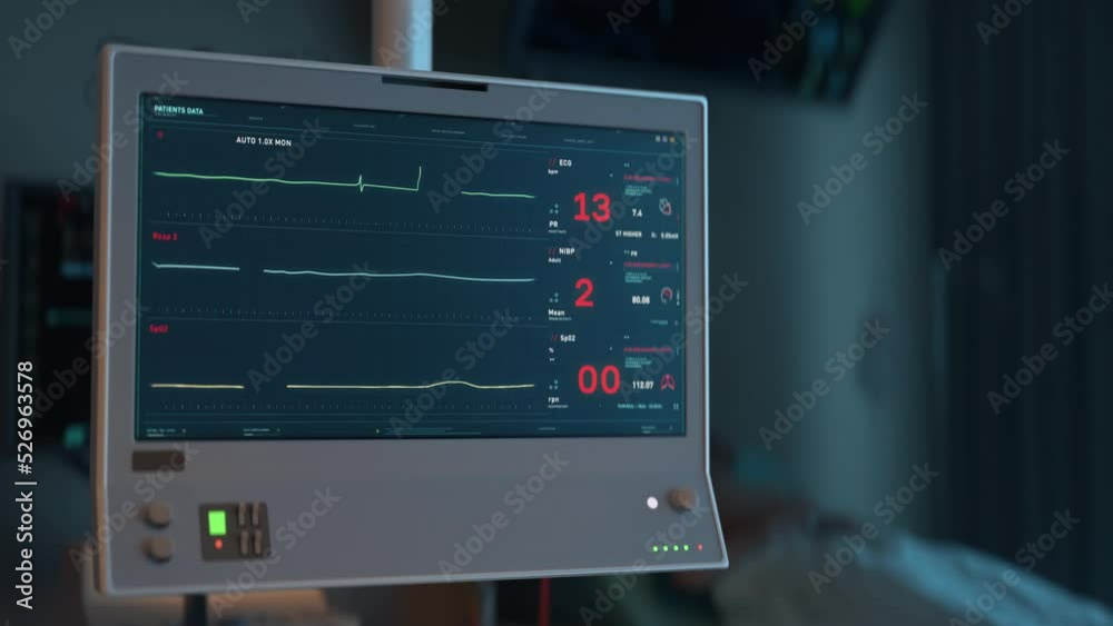 Analyzing the heart rate of a patient in the emergency ward. Modern ...