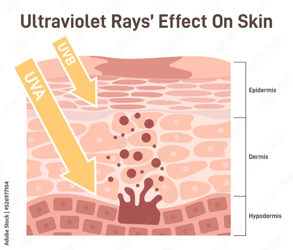 How UV rays effect on skin. UVA, UVB rays go through the skin cells ...
