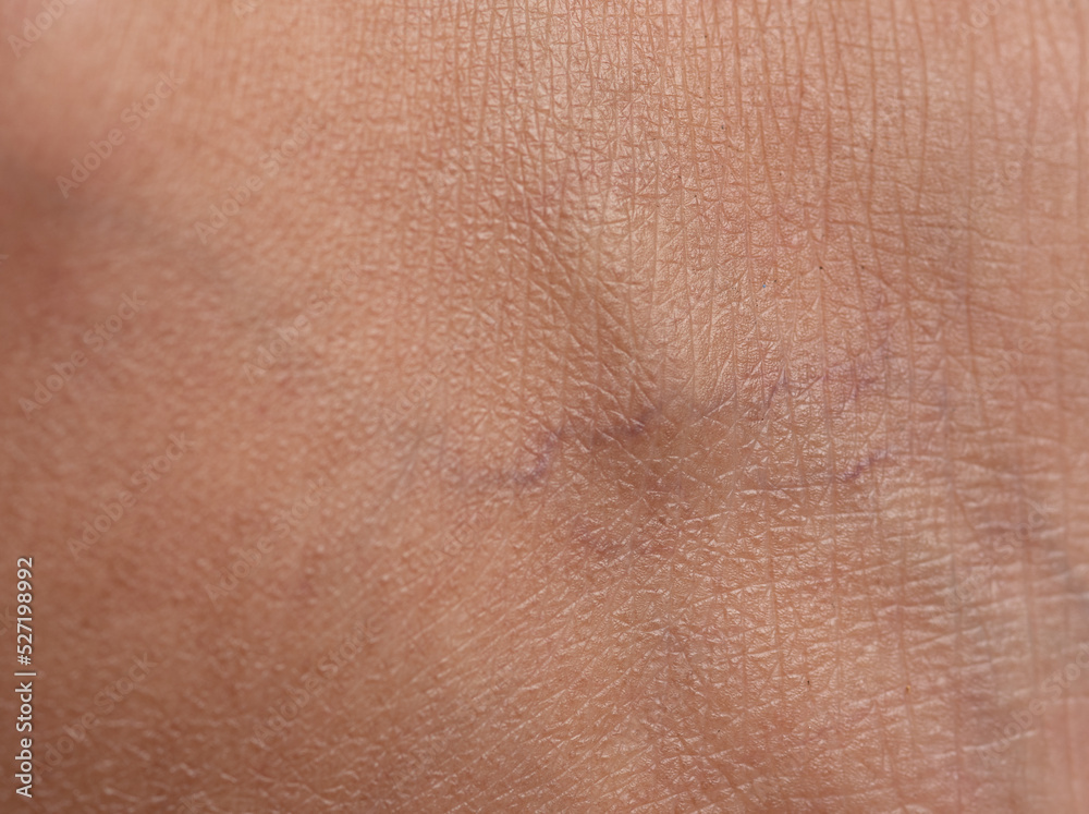 Human skin texture background,brown skin Stock Photo | Adobe Stock