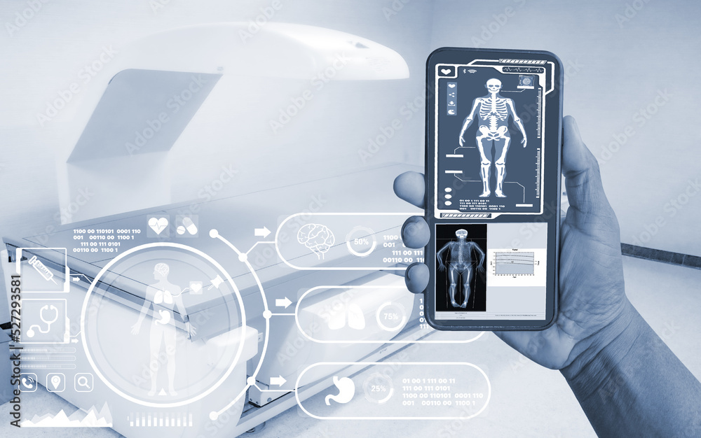 Close-up hand Doctor showing Image of DXA bone density scan on a ...