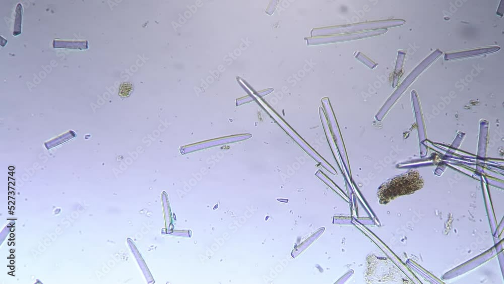 Spincule of Spongia whole mount under microscope 200x on white ...