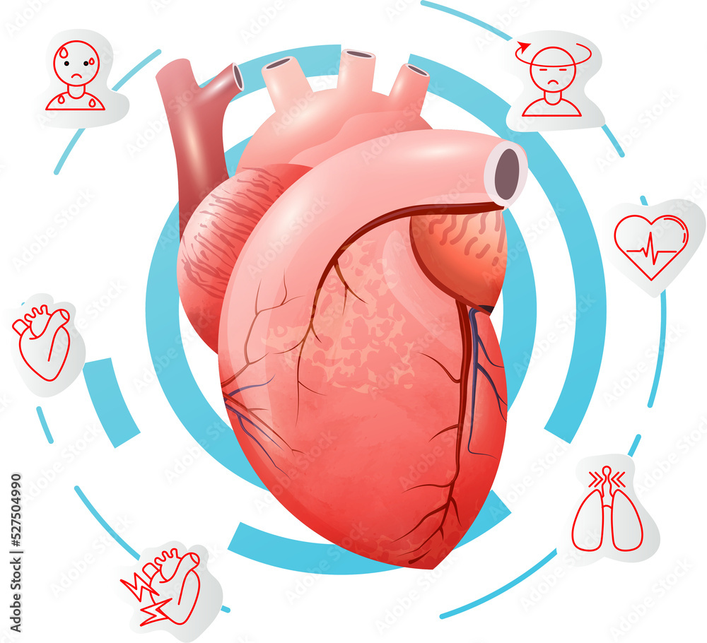 Heart attack, sign, and symptom of the disease. A concept hospital for ...