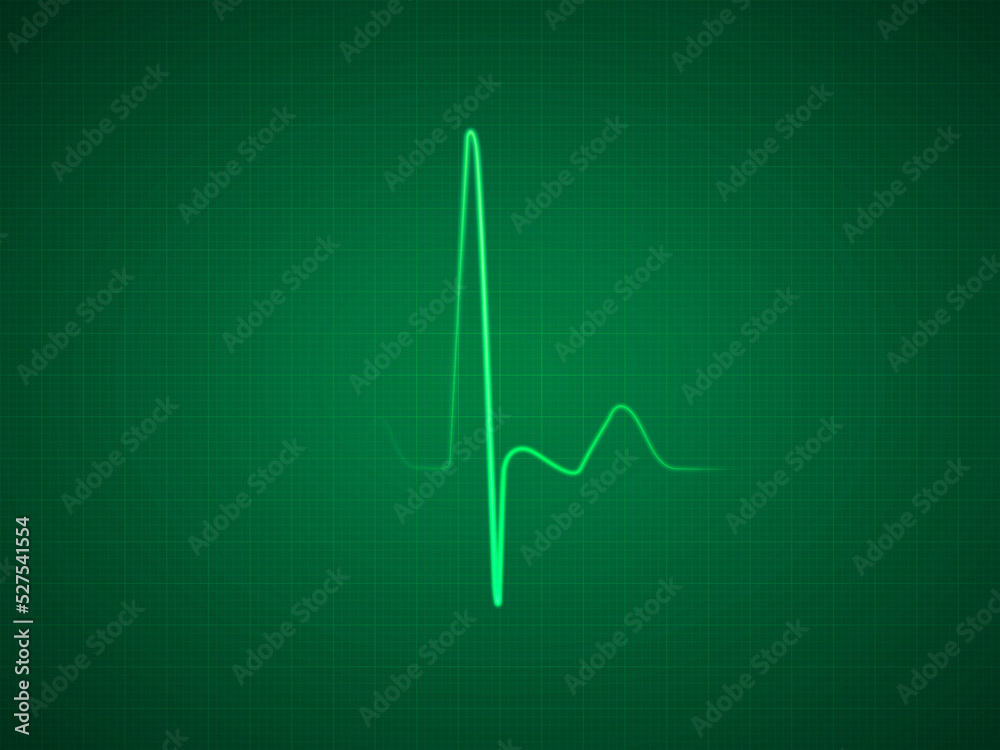 Green ECG EKG Diagram of a Stabil Patience ilustração do Stock | Adobe ...
