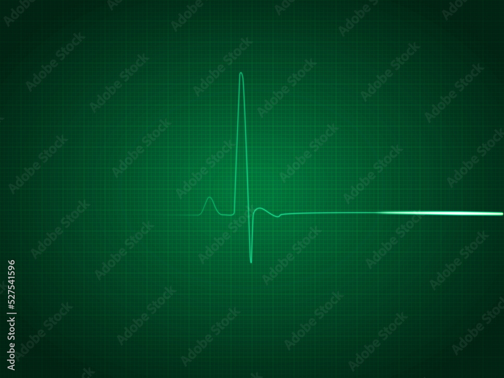 Green ECG EKG Diagram of a Flatline Patience Stock Illustration | Adobe ...