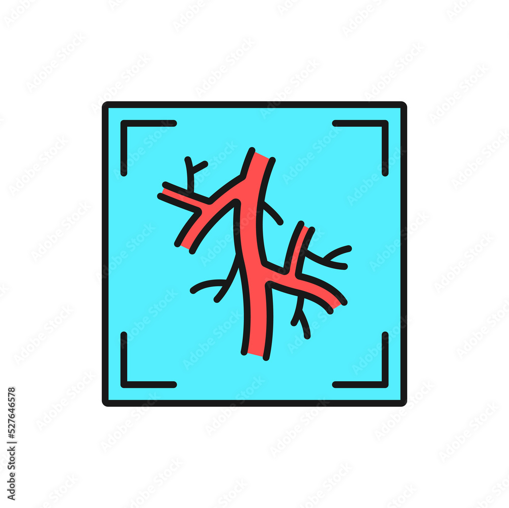 MRI diagnostics, tomography and CT radiology scan angiography of ...