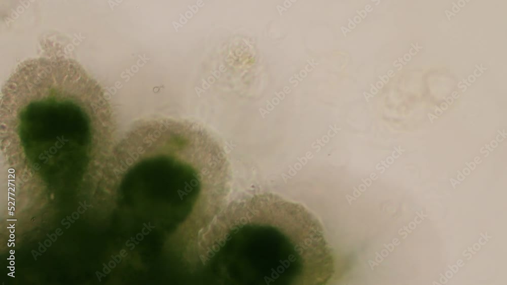 Hydra under the microscope, Hydra is a genus of small, fresh-water ...